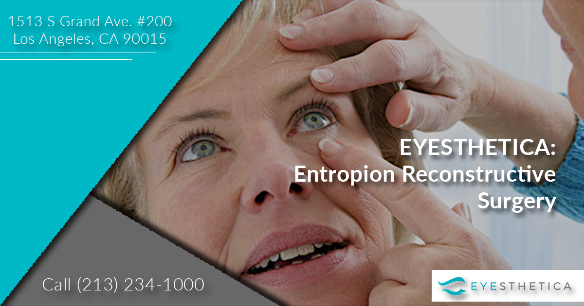 What Is Entropion Surgery