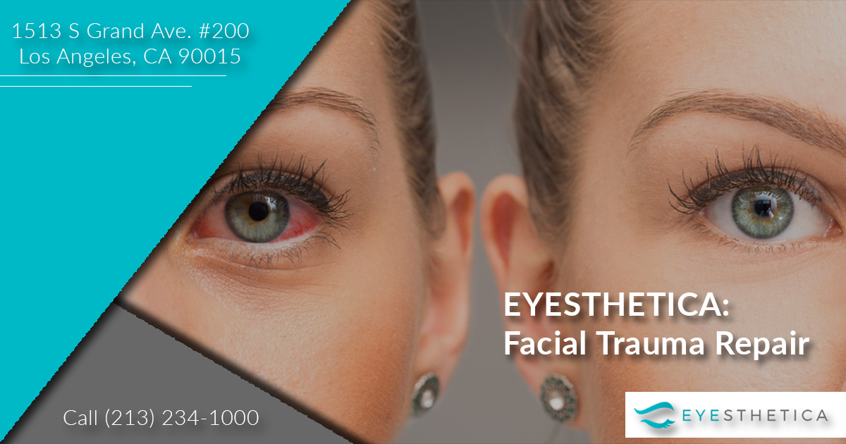 Facial Trauma Treatment LA | Orbital Fracture Repair | Eyesthetica